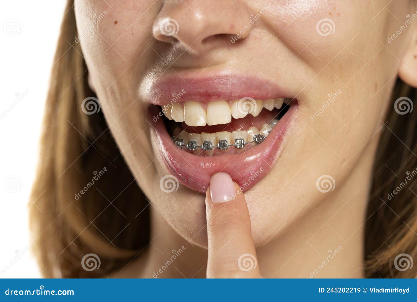 Woman Showing Her Dentures on Lower Teeth Stock Image - Image of ...