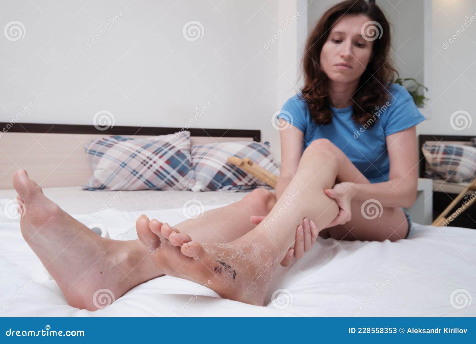 A Woman Sitting On The Bed Massages Her Leg After A Fracture Home