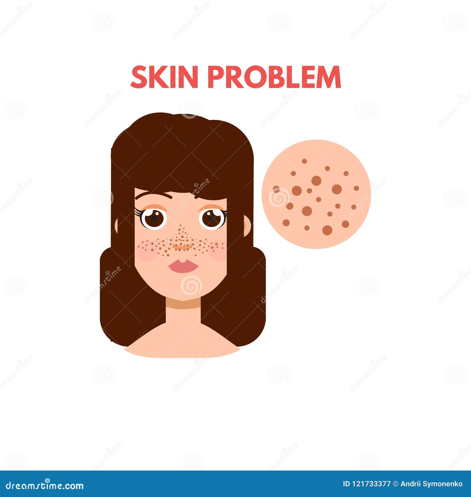 Woman with Skin Problem. Vector Stock Vector - Illustration of human ...