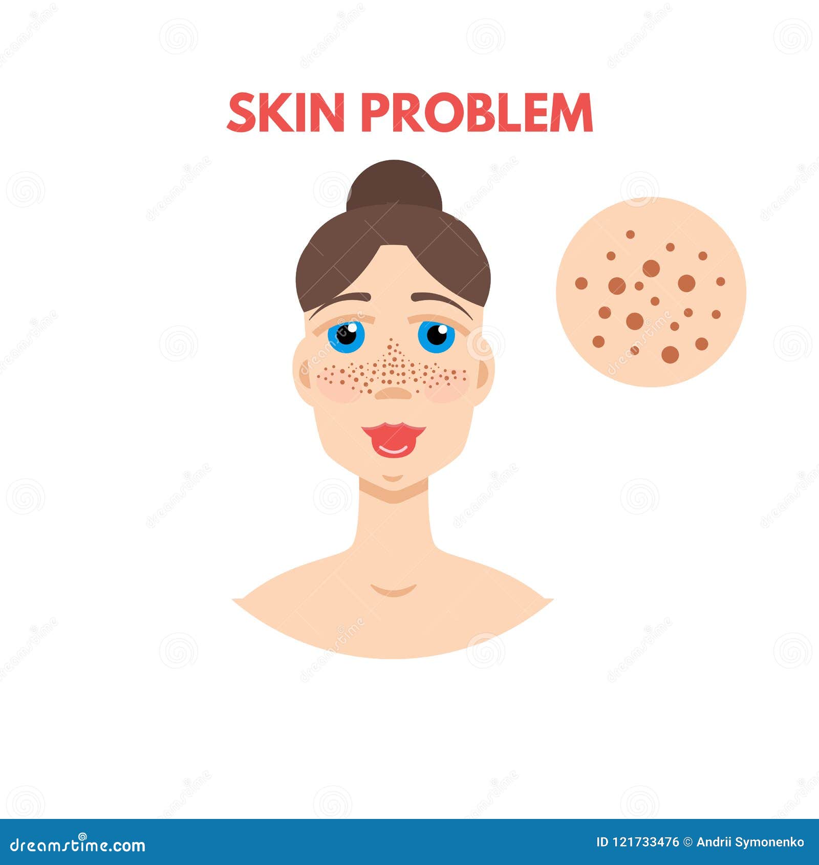 Woman with Skin Problem. Vector Stock Vector - Illustration of aging ...