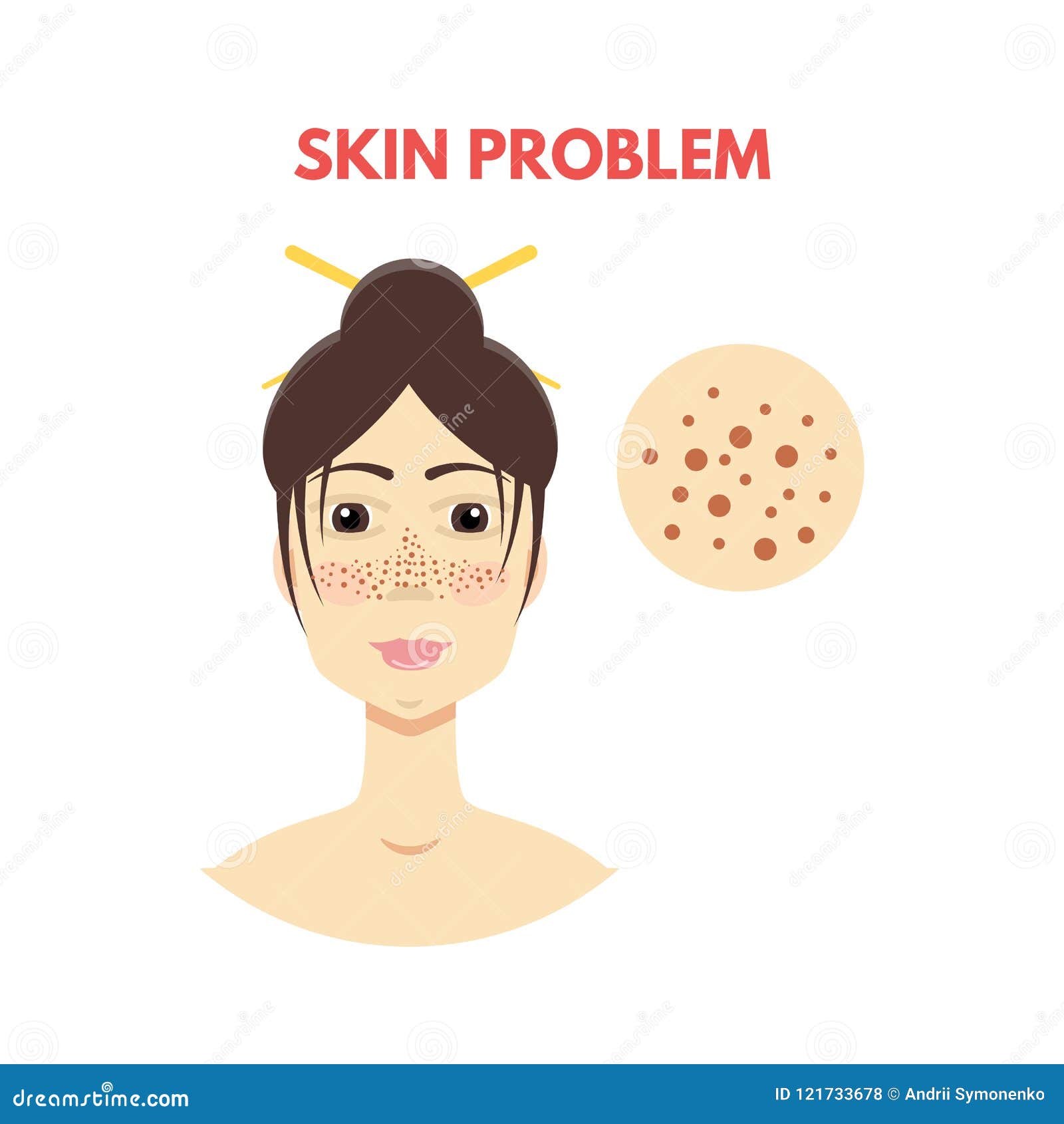 Woman with Skin Problem. Vector Stock Vector - Illustration of ...