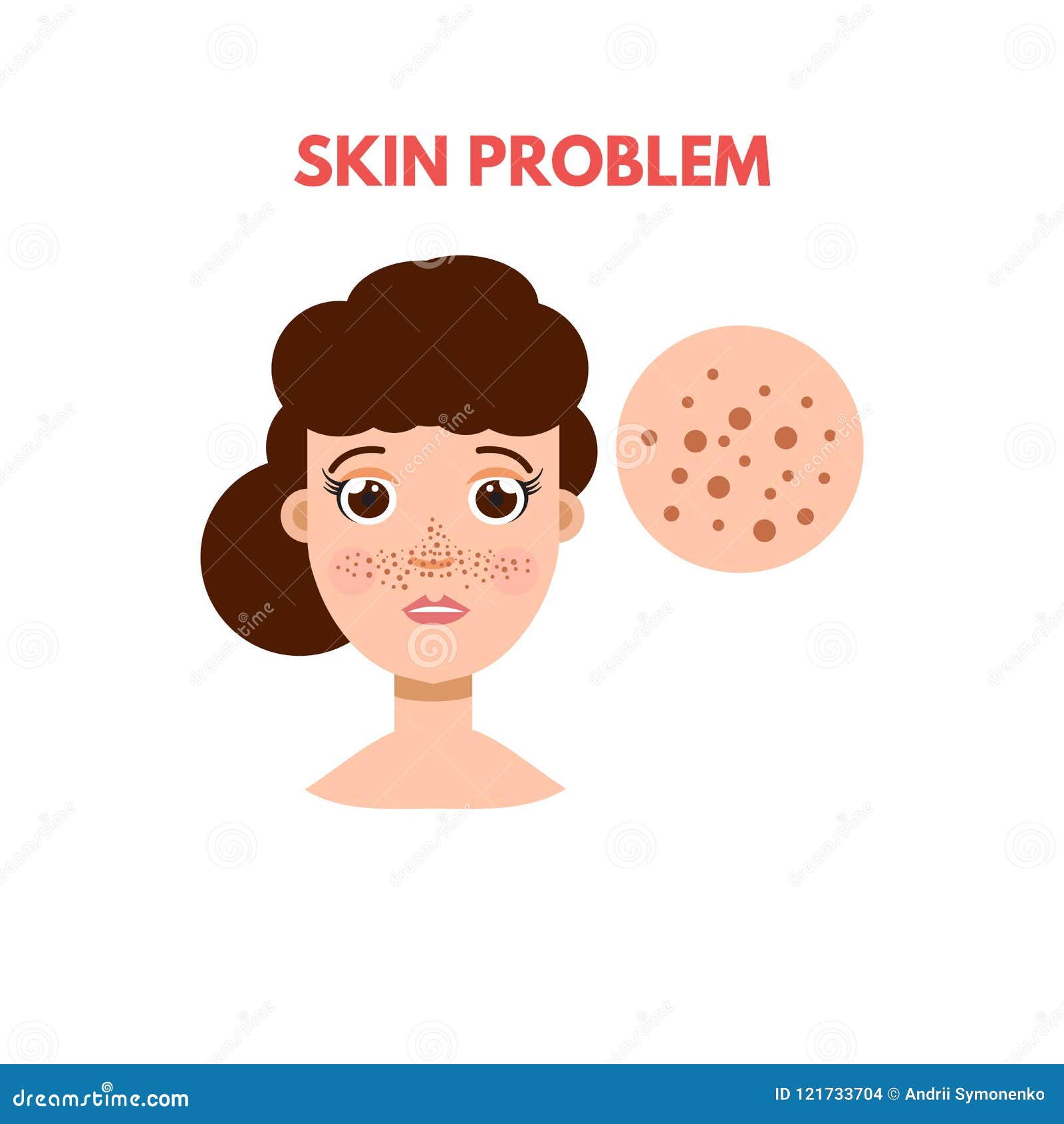 Woman with Skin Problem. Vector Stock Vector - Illustration of ...