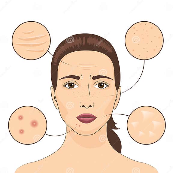 Woman Skin Problem Vector Illustration Female Face With Skins