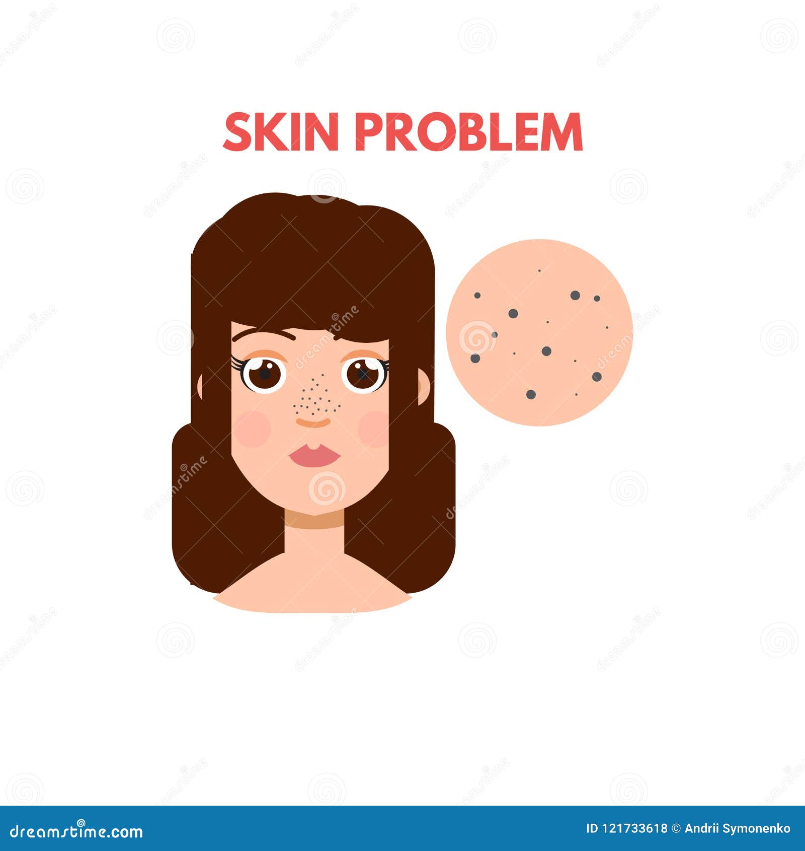 Woman with Skin Problem. Vector Stock Vector - Illustration of human ...