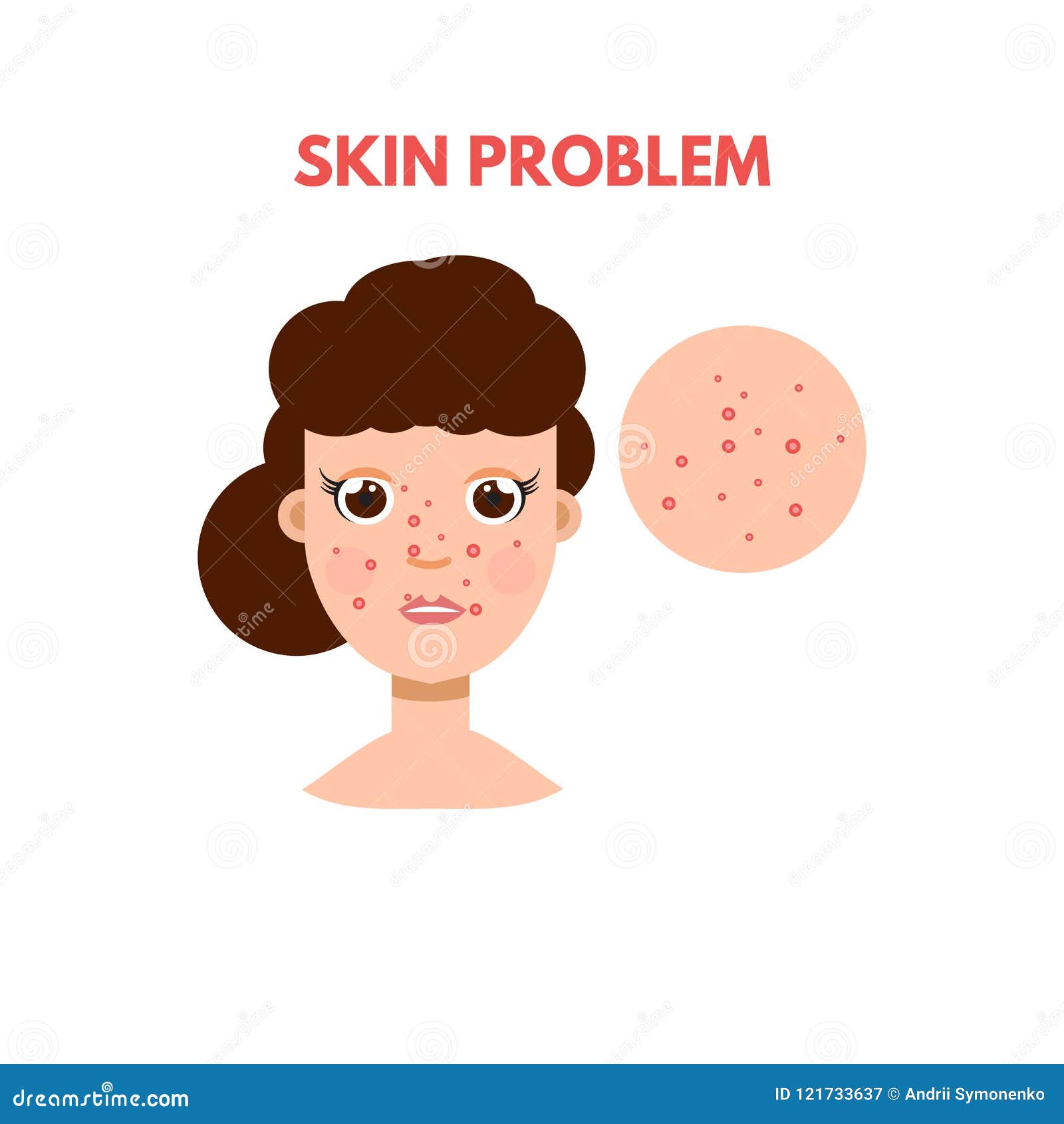 A Woman With A Abscess On Her Armpit. Illustration On White Background ...