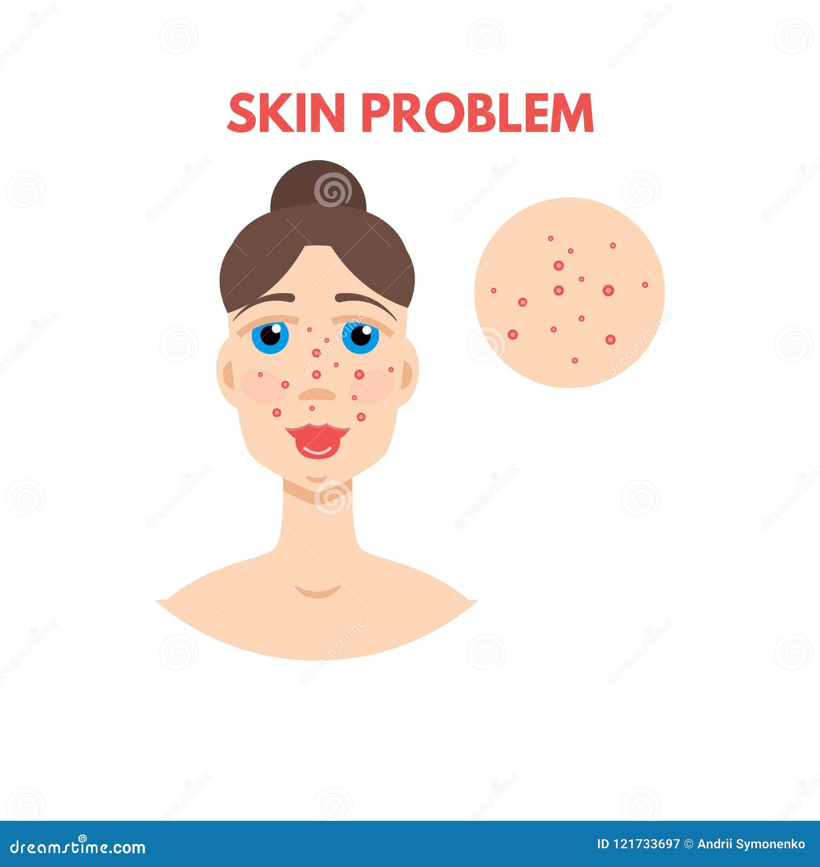 Woman with Skin Problem. Vector Stock Vector - Illustration of ...