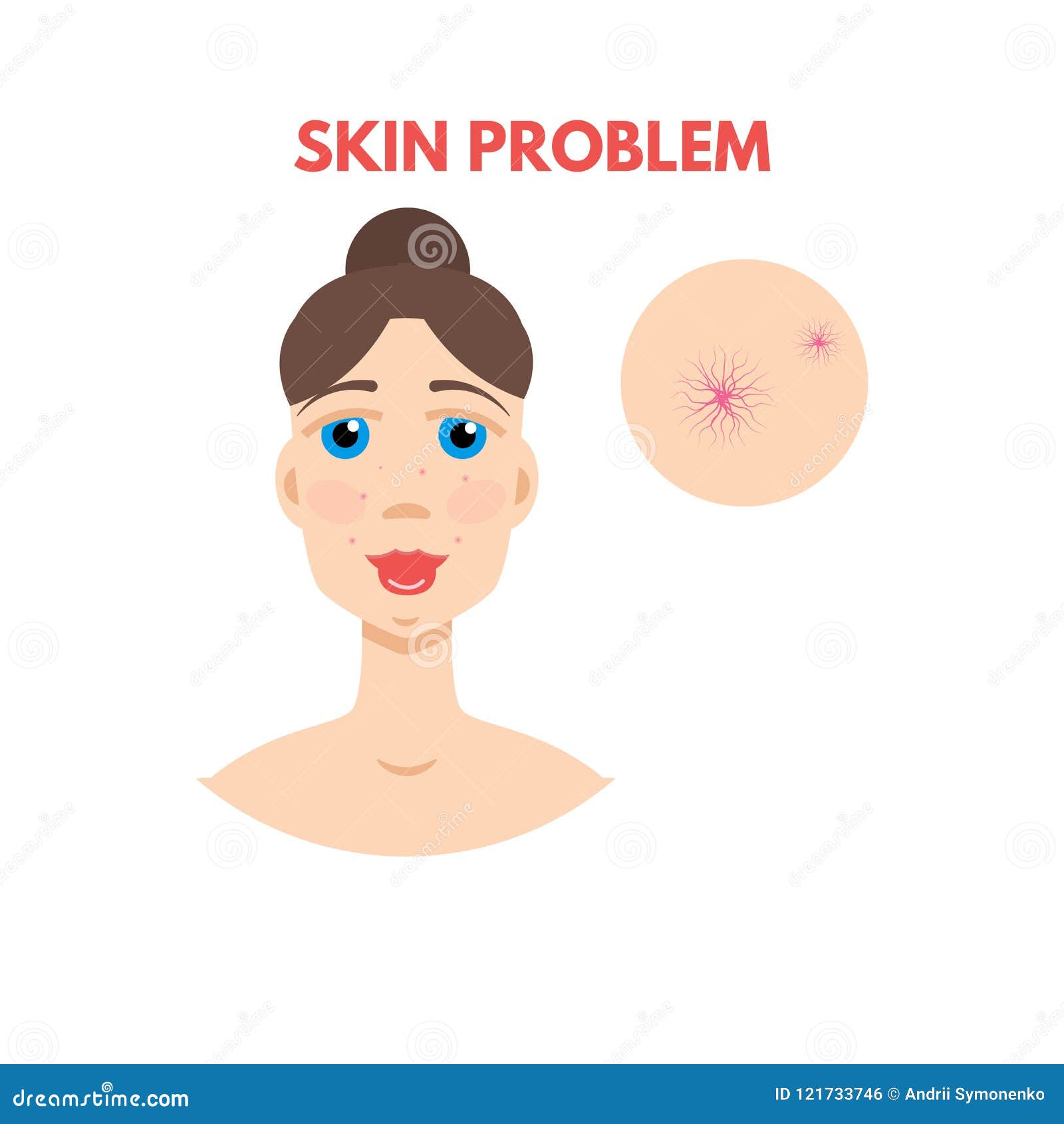 Woman with Skin Problem. Vector Stock Vector - Illustration of person ...