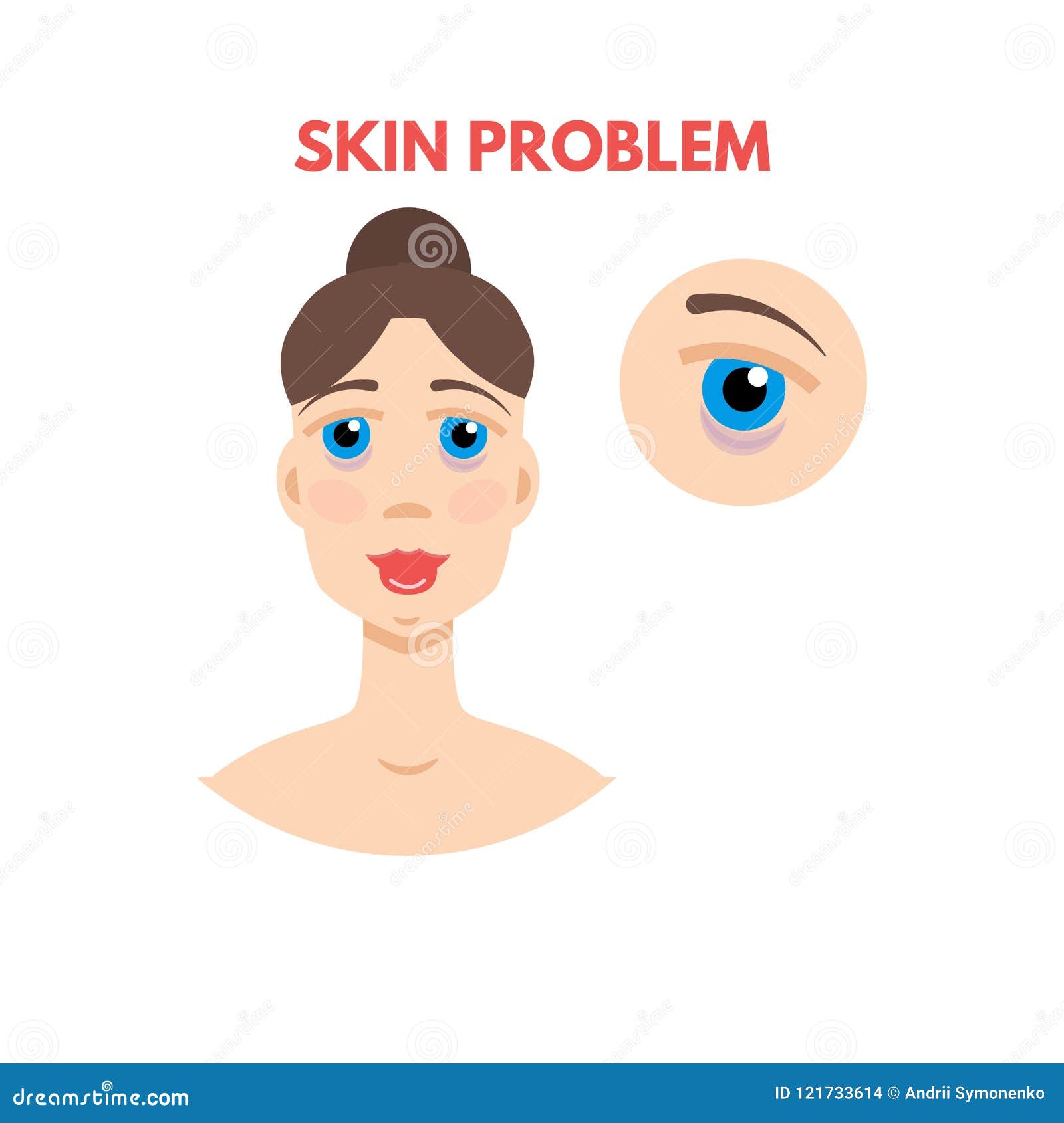 Woman with Skin Problem. Vector Stock Vector - Illustration of blemish ...