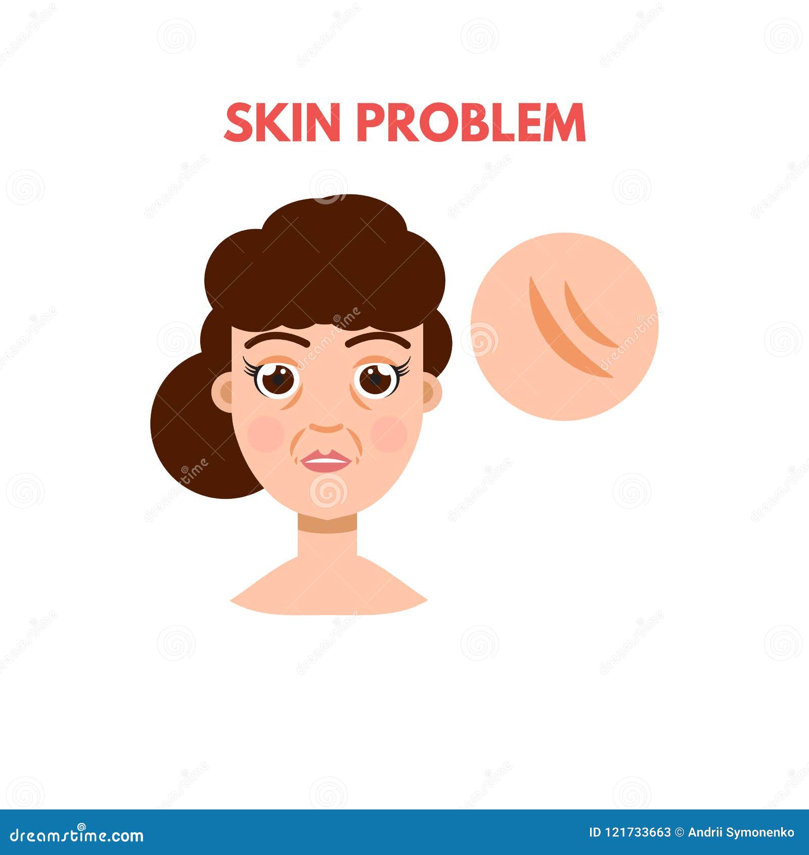 Woman with Skin Problem. Vector Stock Vector - Illustration of acne ...