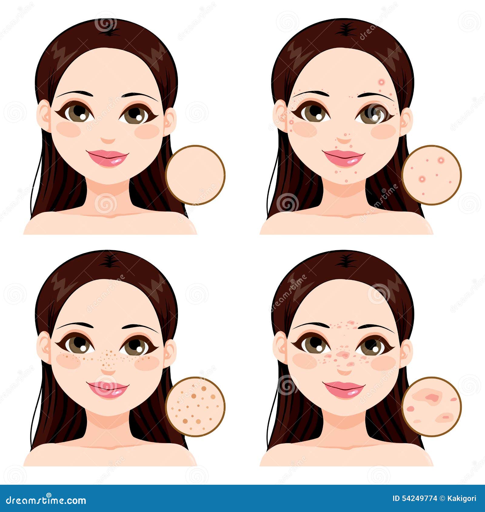 Compared Skin Stock Illustrations – 22 Compared Skin Stock Illustrations, Vectors & Clipart ...