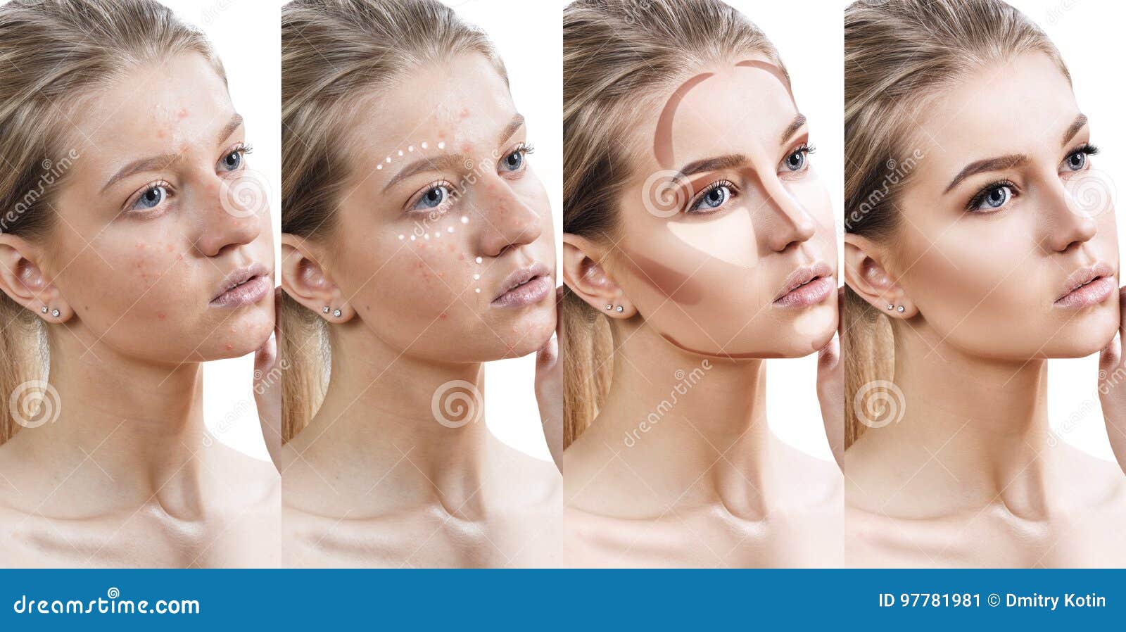 Woman Step by Step Improves Her Skin Condition. Stock Image - Image of ...