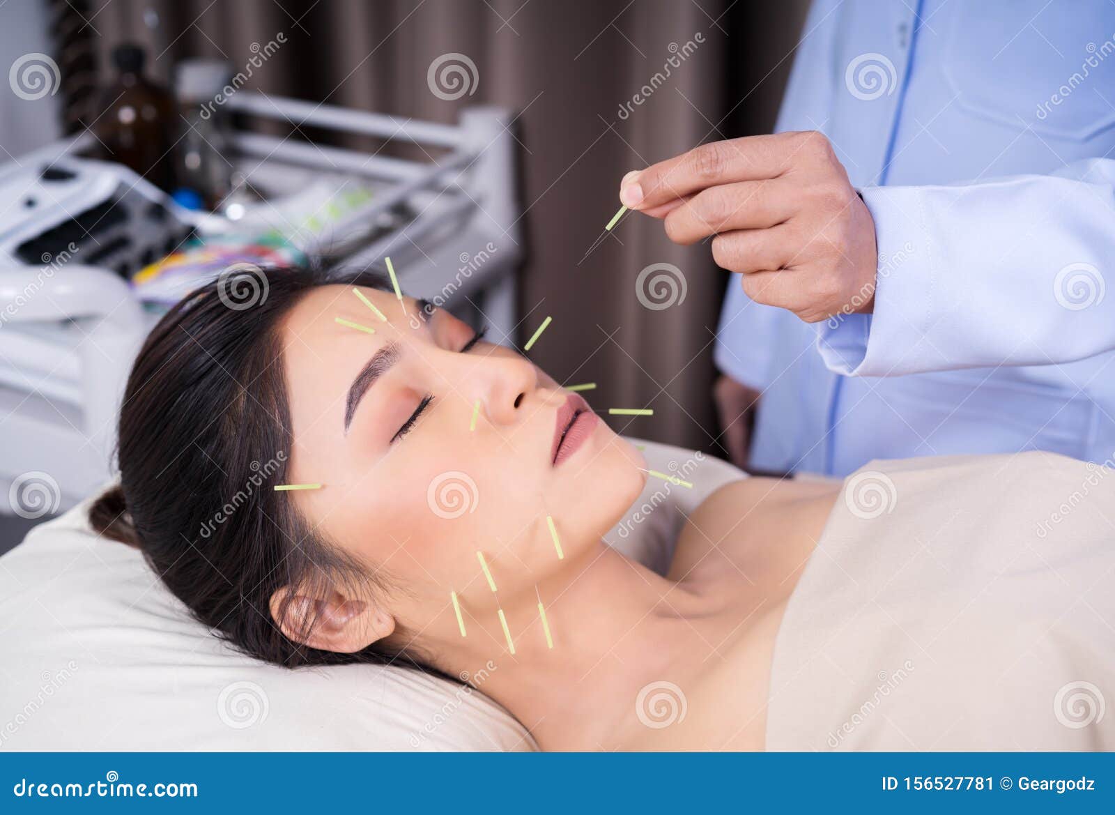 Woman Undergoing Acupuncture Treatment on Face Stock Image - Image of ...