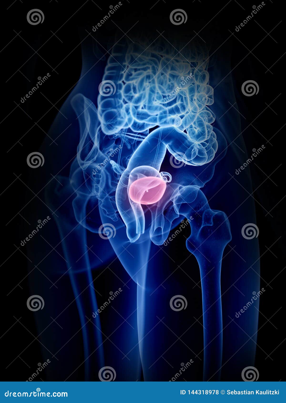 A womans bladder stock illustration. Illustration of infection - 144318978