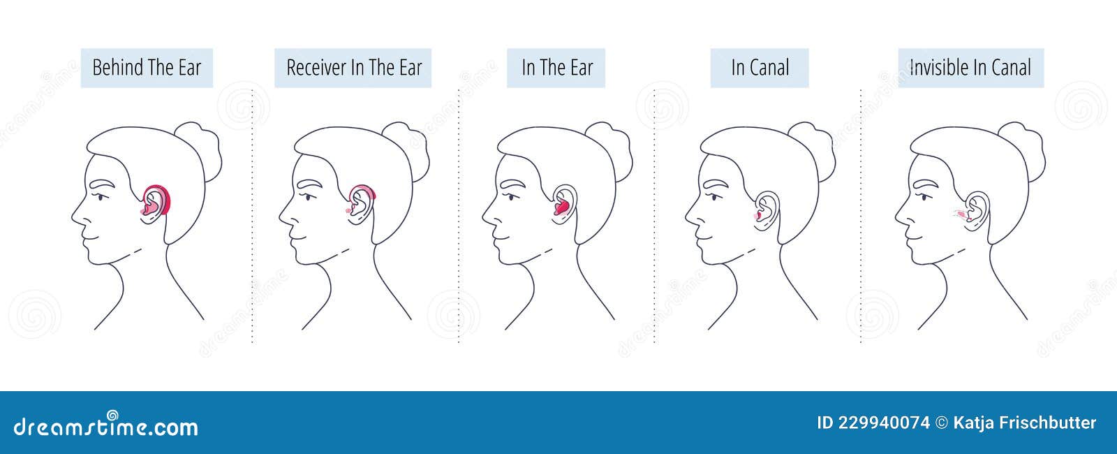 A Womans Head with Different Categories of Hearing Aids for the Hearing ...