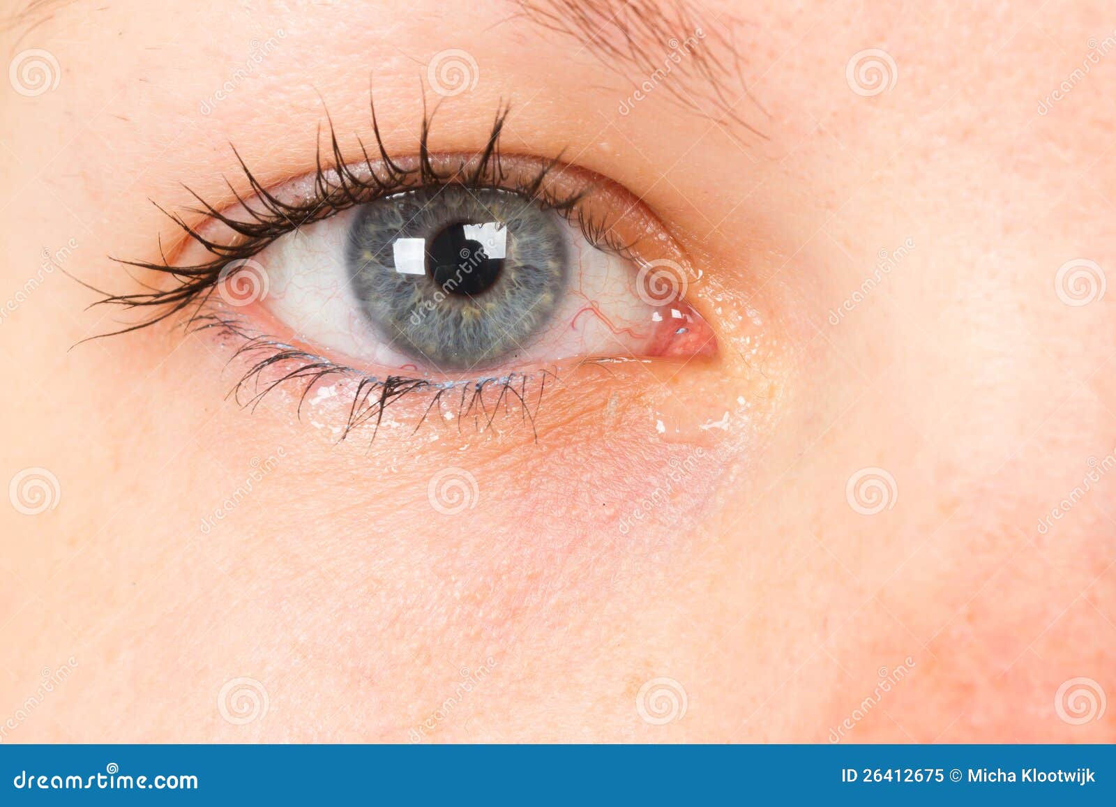 Women Eye, Close-up, Blue, Tear Stock Image - Image of hope, eyelash ...