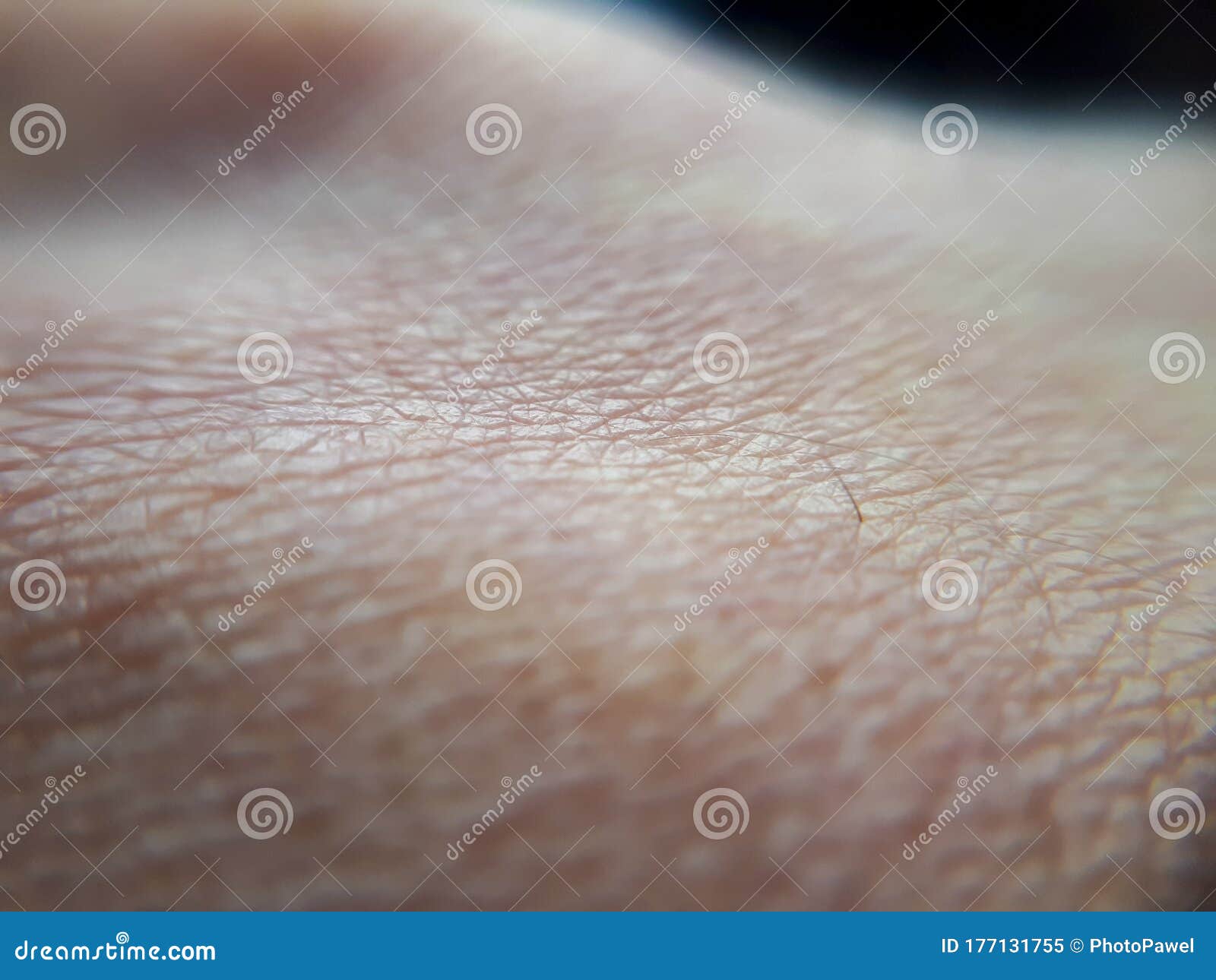 Women person skin macro stock image. Image of dermatological - 177131755