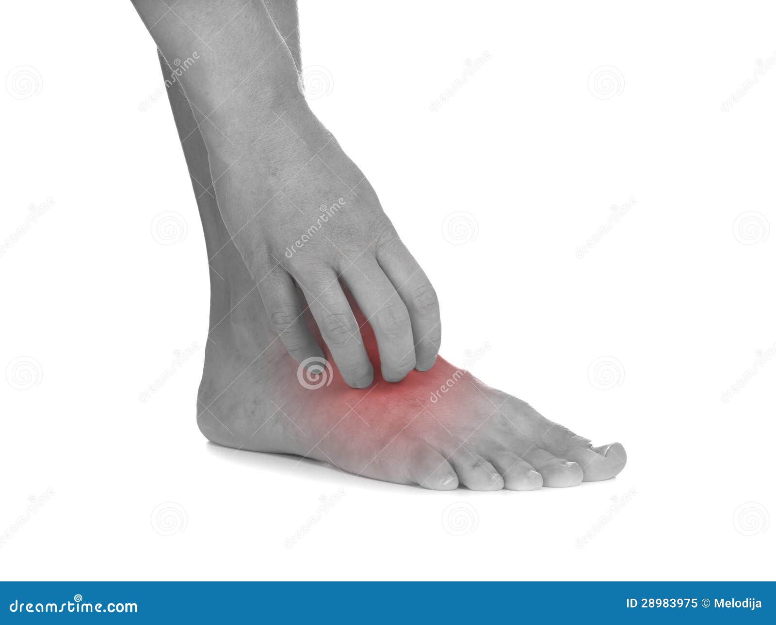 Women Scratch Itchy Leg with Hand. Stock Image - Image of illness ...