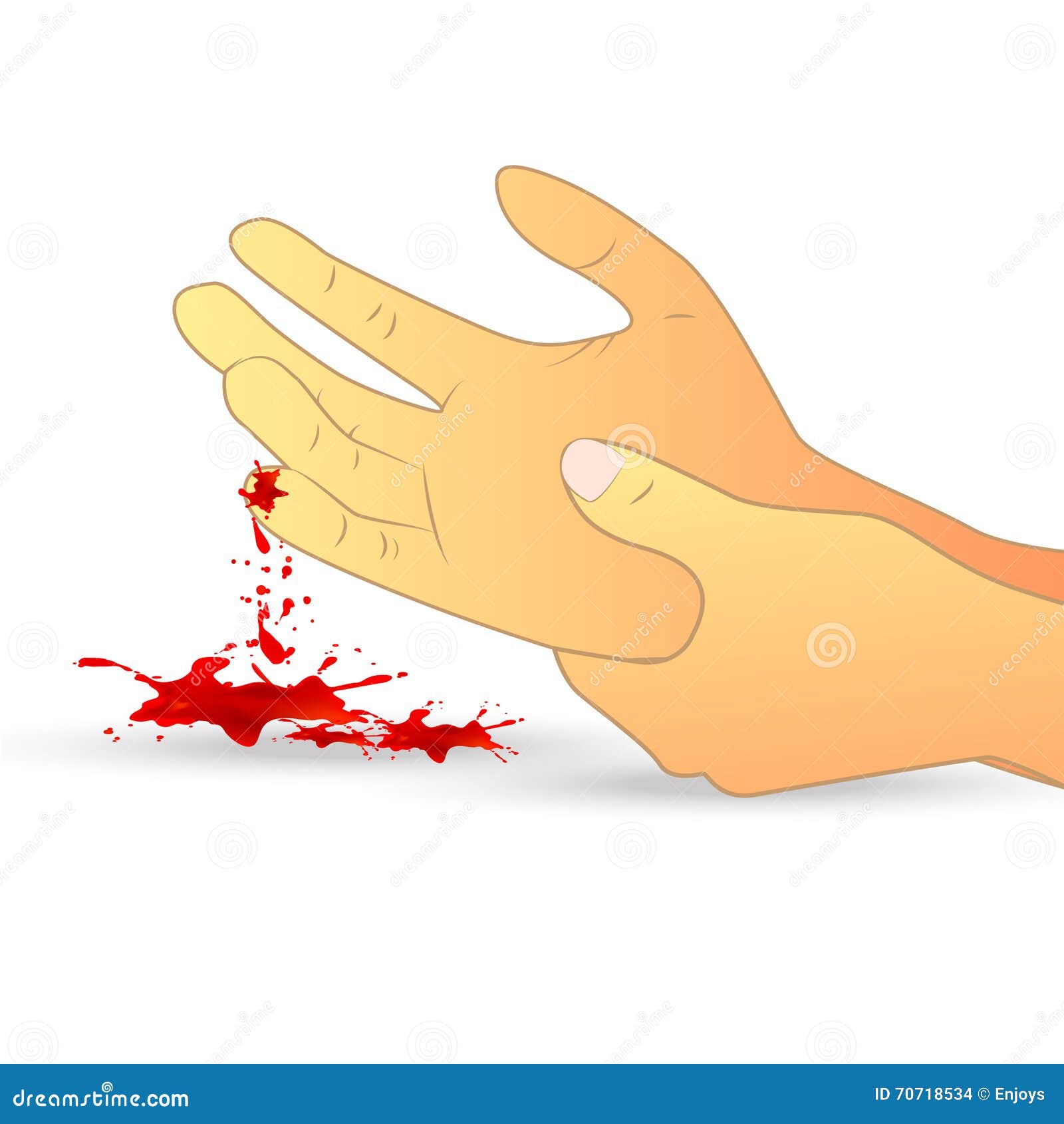 Wond op de handillustratie stock illustratie. Illustration of eenvoudig ...