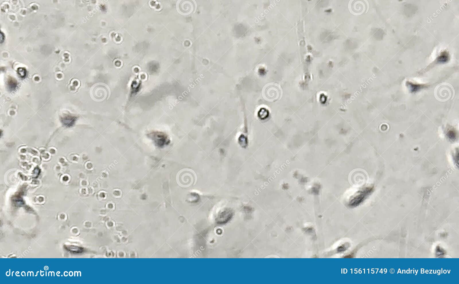 Human Sperm Under Microscope