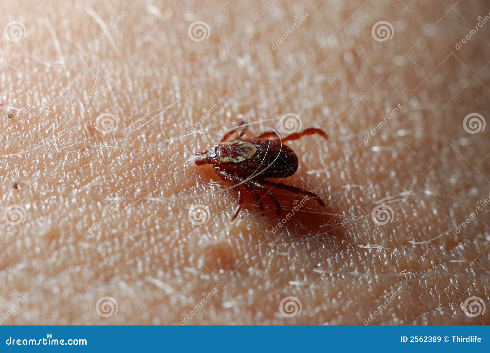 Wood Tick, Ixodes Ricinus, Specimen - Angled Side View, Isolated On ...