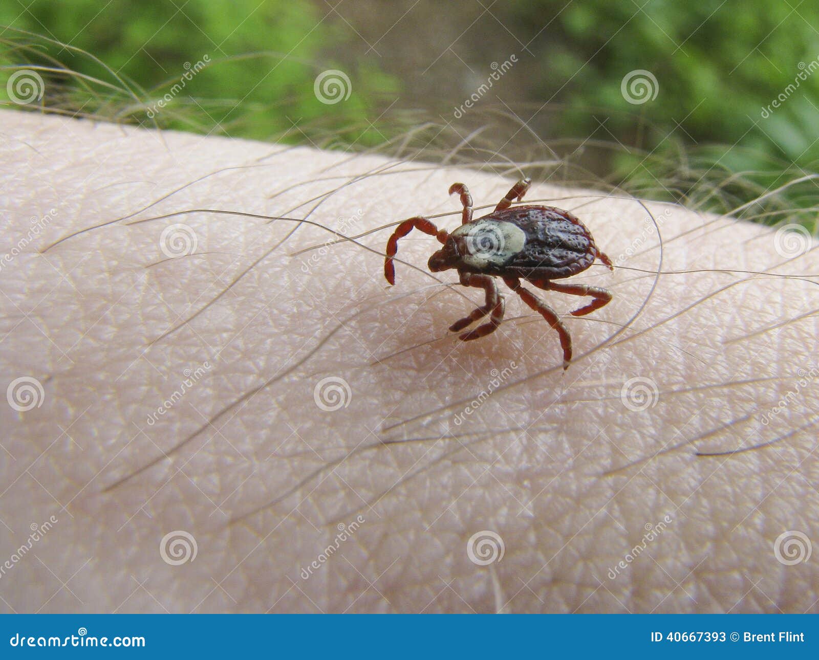 Wood Tick, Ixodes Ricinus, Specimen - Angled Side View, Isolated On ...