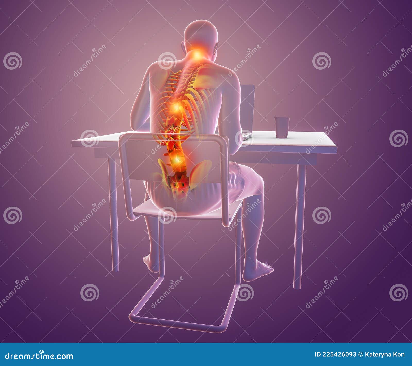 Working with Laptop in a Wrong Position. Concept of Backache, Back Pain ...
