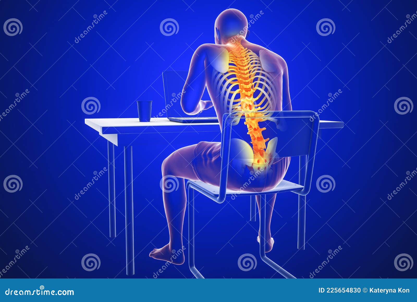 Backache, Back Pain Royalty-Free Stock Photography | CartoonDealer.com ...