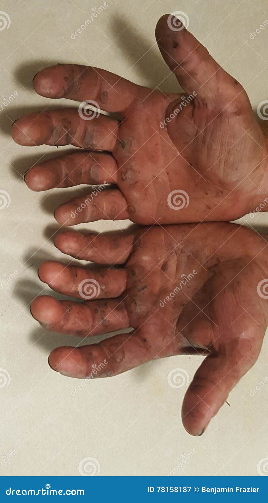 Working man hands stock image. Image of dirty, blistered - 78158187