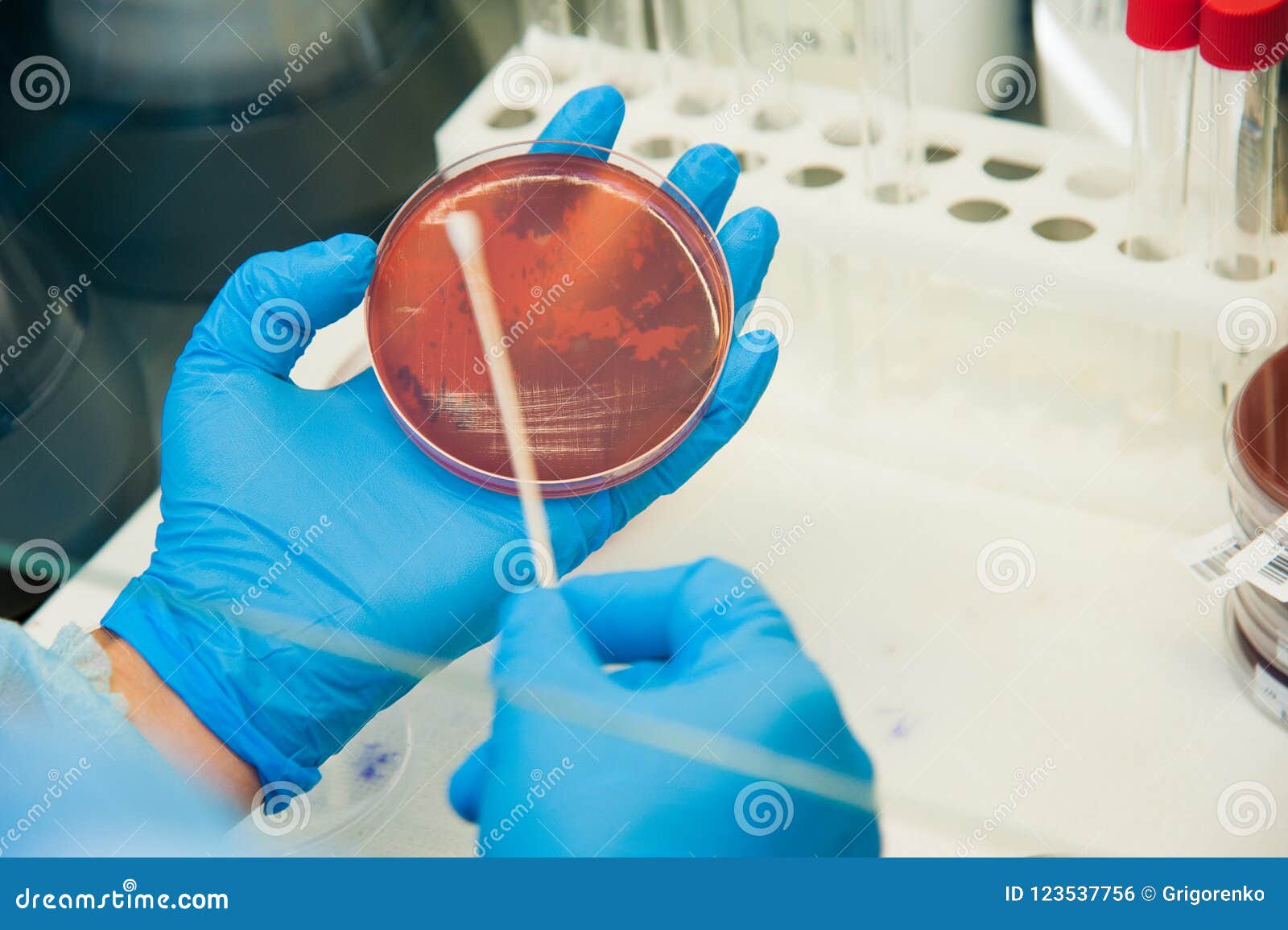 Microbiology Research in Laboratory Stock Photo - Image of analysis ...