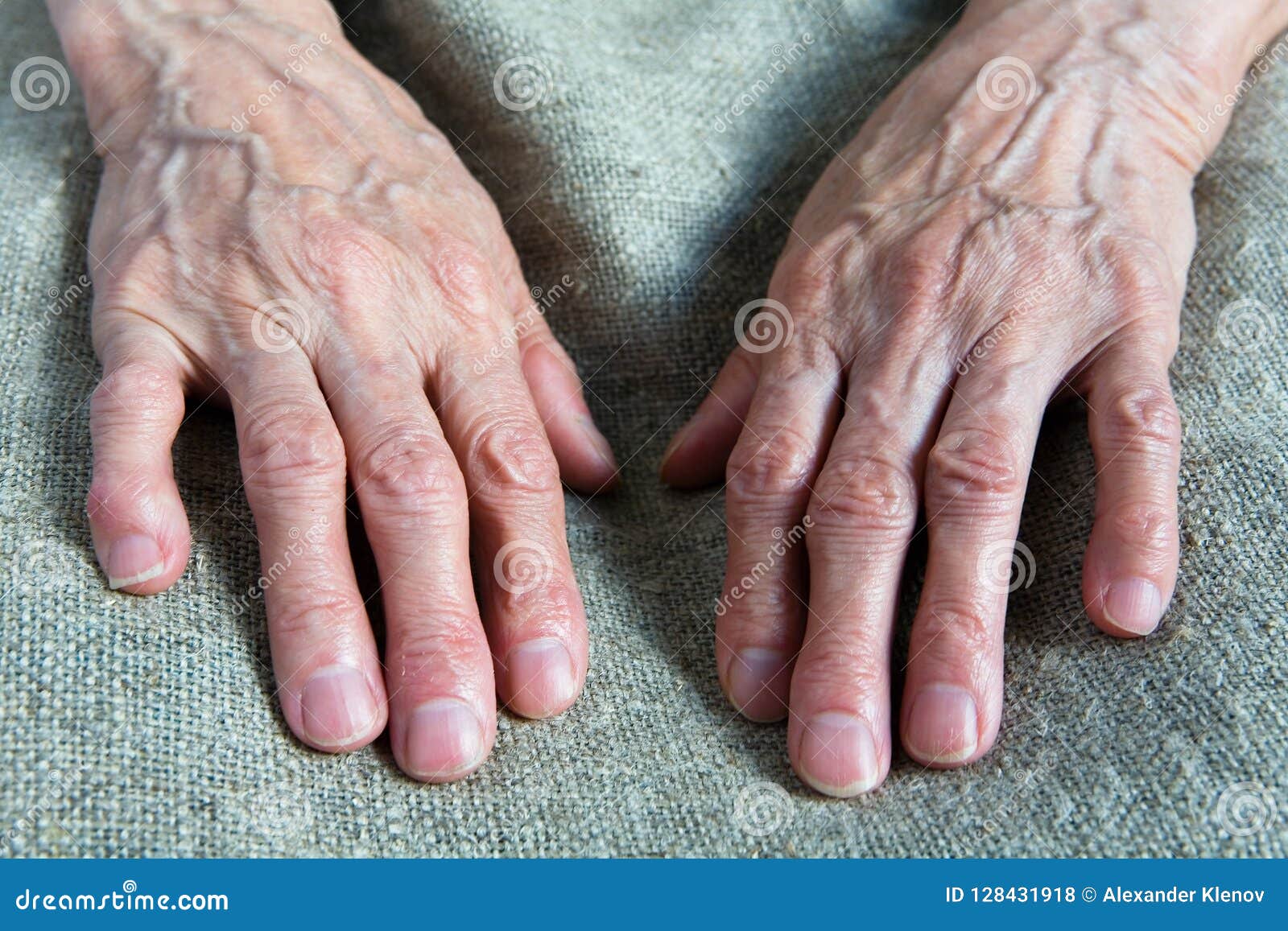 Working Wrinkled Hands of an Old Woman. Stock Photo - Image of elderly ...