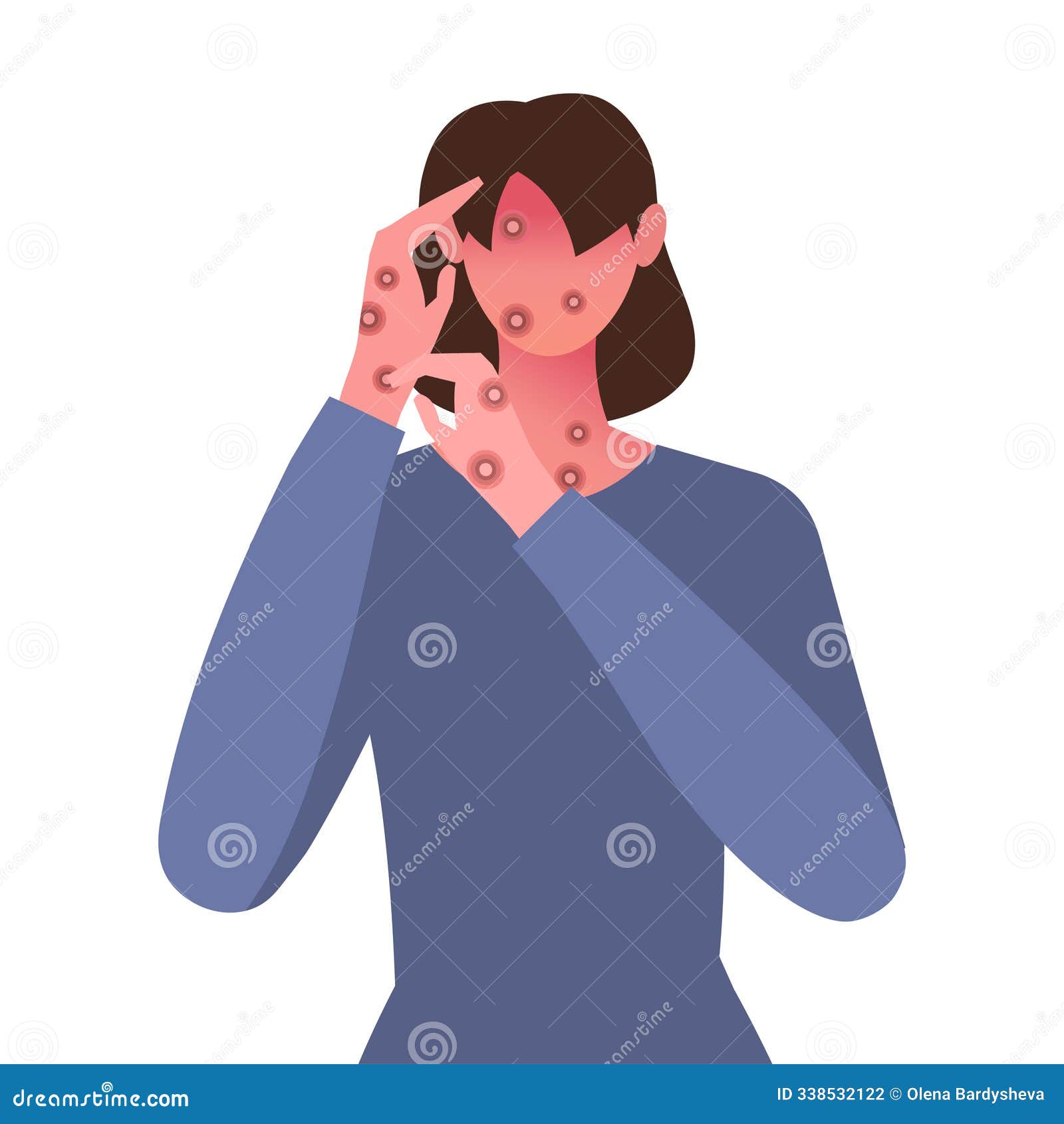 Monkeypox Virus Cells And Human Skin With Rash Cartoon Vector ...
