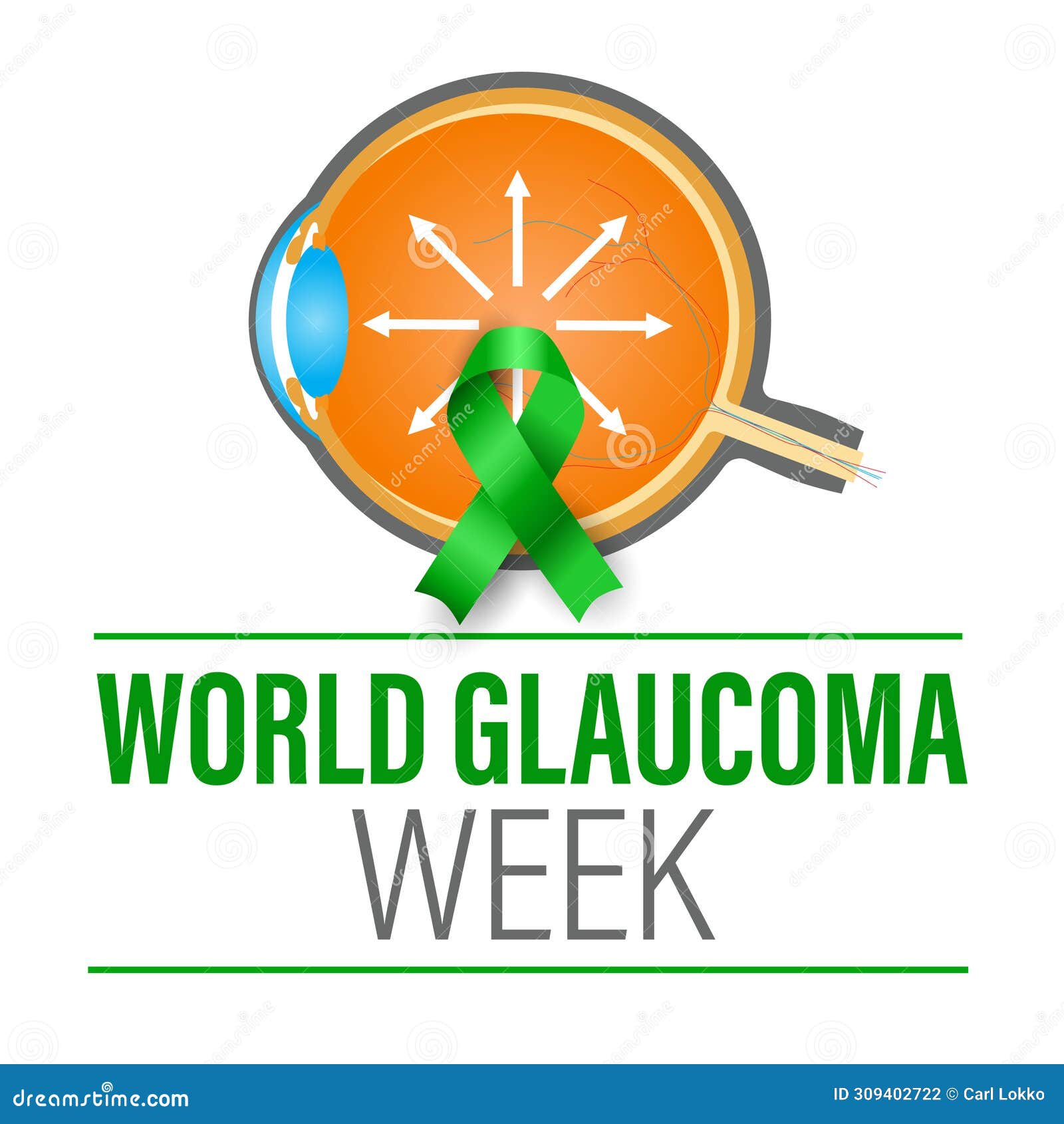 World Glaucoma Week. Observed in March. Ocular Pressure on Optic Nerve ...
