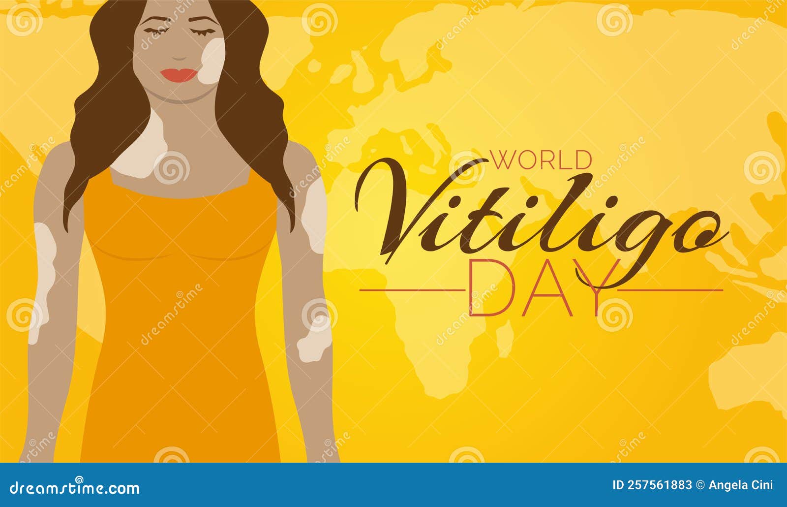 World Vitiligo Day June 25 Banner. Female Faces With Different Ethnics ...