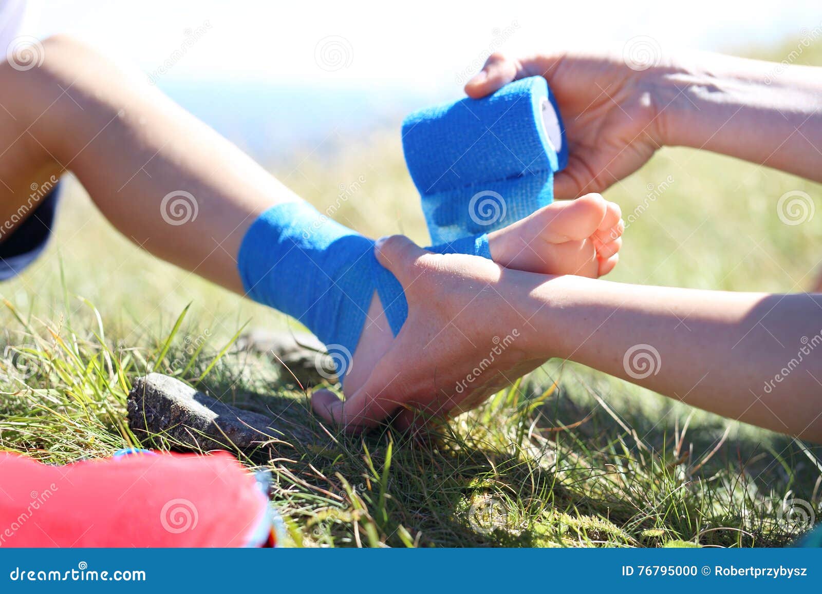 Wound broken leg. stock photo. Image of ankle, bandages - 76795000