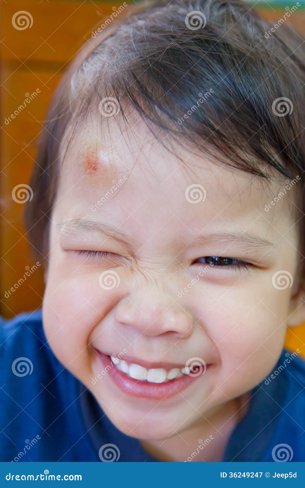 Wound child stock image. Image of little, caucasian, body - 36249247