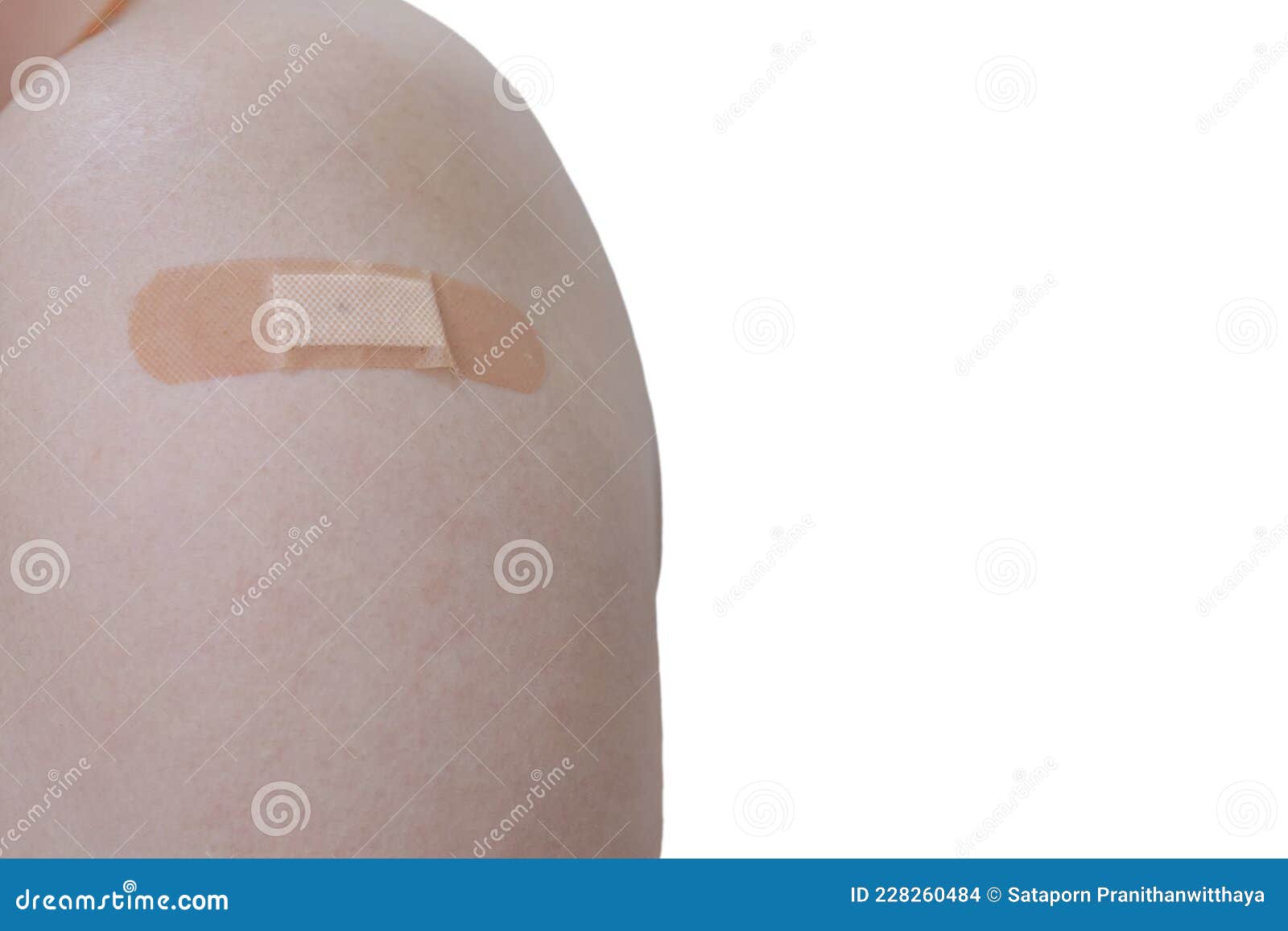 BCG Vaccination Wound On Shoulder Royalty-Free Stock Photo ...