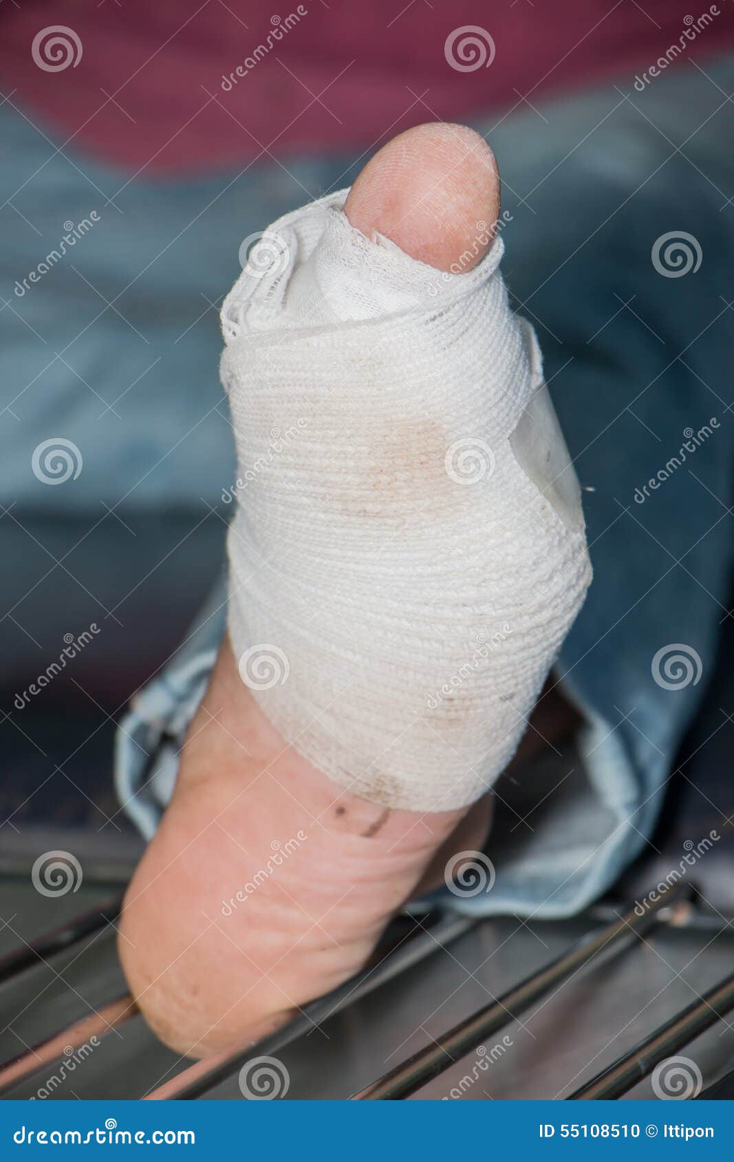 Wound of diabetic foot stock photo. Image of infection - 55108510