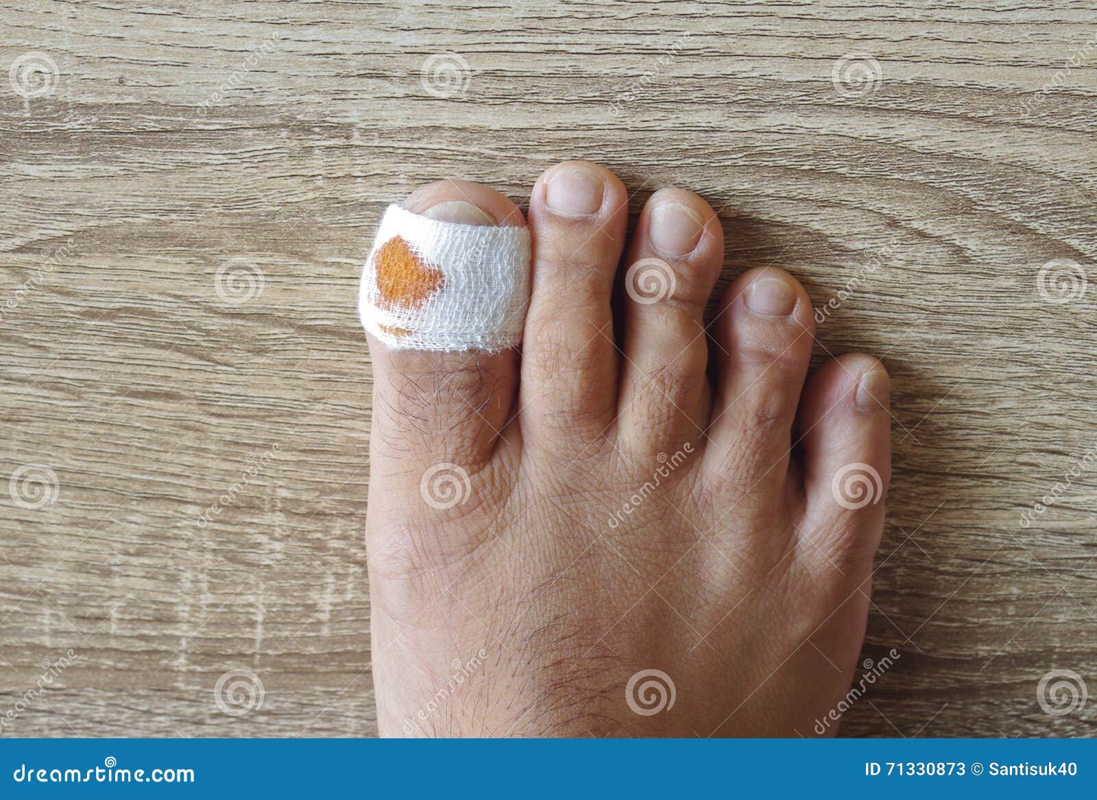 Wound at foot stock image. Image of closeup, bloody, body - 71330873