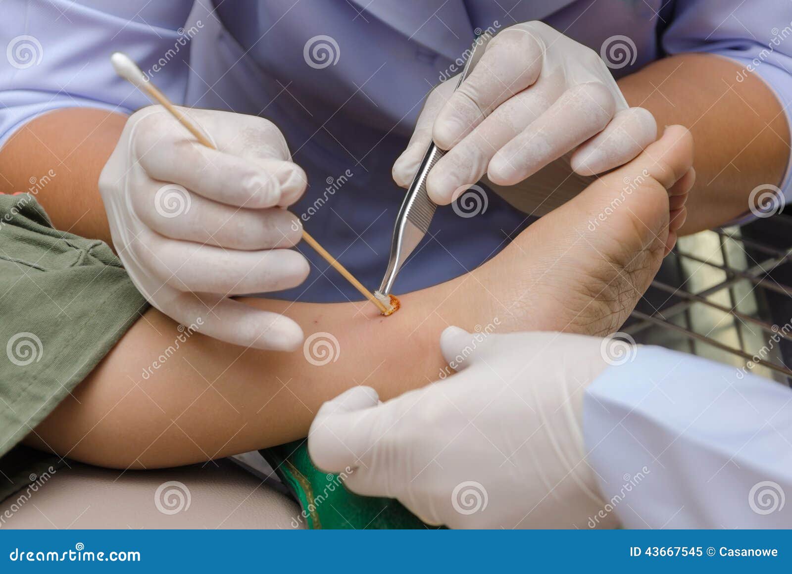Wound Healing On Leg Of Child And Lying Down Hospital Bed Stock Image ...