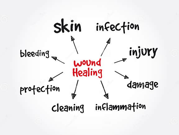 Wound Healing Mind Map, Health Concept for Presentations and Reports ...