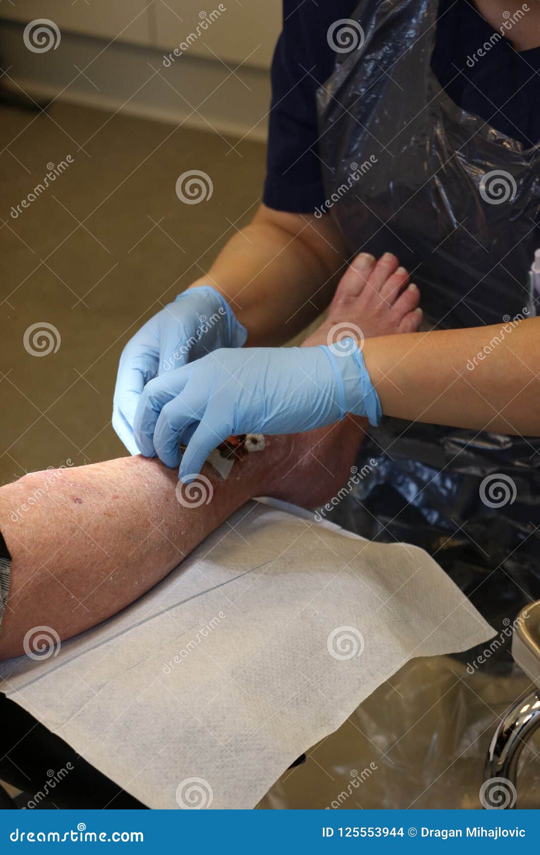 Wound on the leg stock photo. Image of pain, open, hospital - 125553944