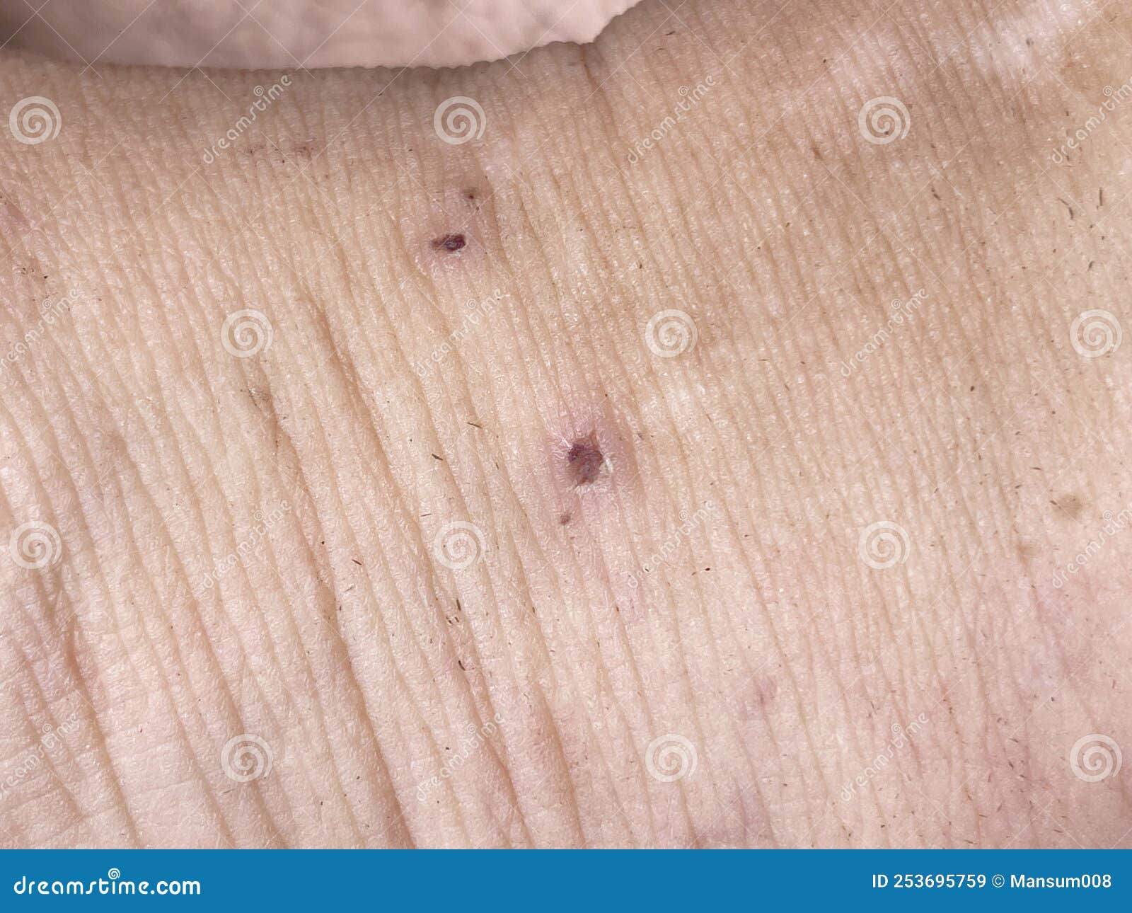 Wound on skin leg stock image. Image of sick, wound - 253695759