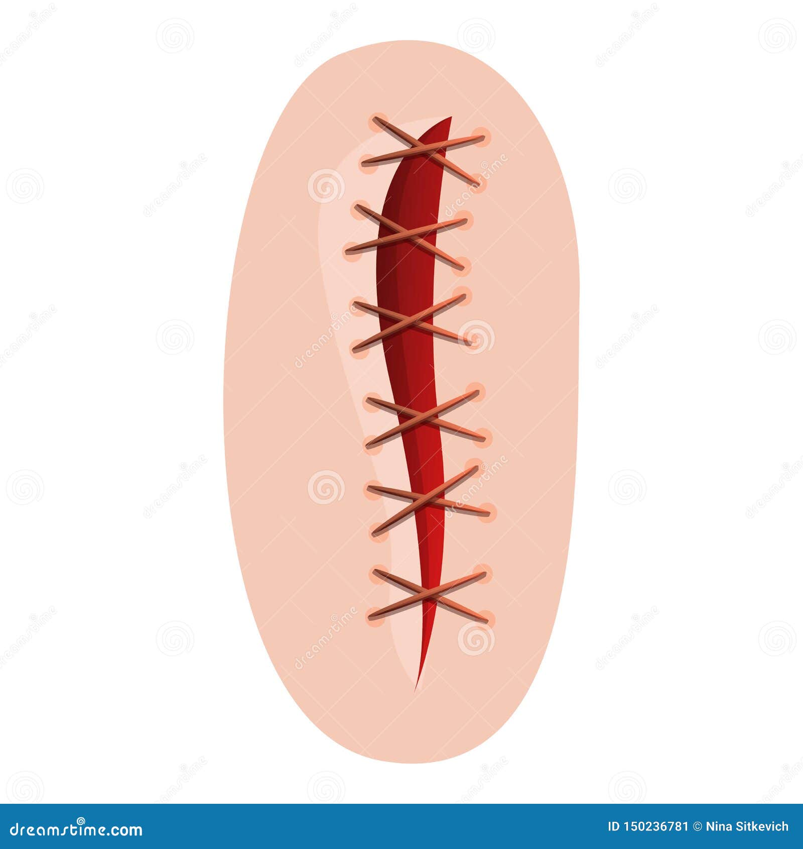 Wound Suture Icon, Cartoon Style Stock Vector - Illustration of ... Wound Suture Icon, Cartoon Style Stock Vector - Illustration of ...