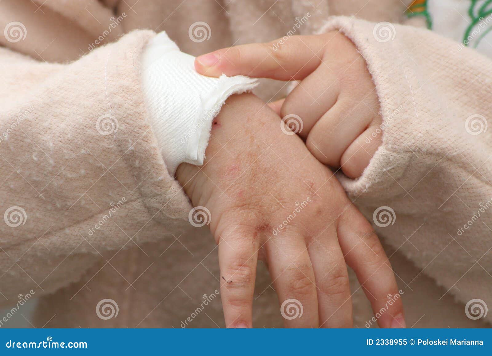 Wounded hand stock image. Image of wounded, wound, playground - 2338955