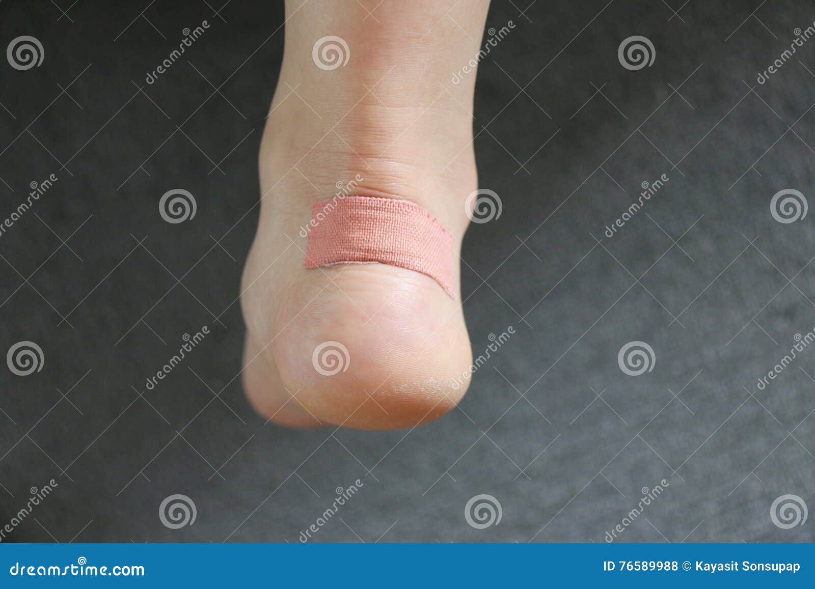 Wounded in the leg stock photo. Image of cotton, burn - 76589988
