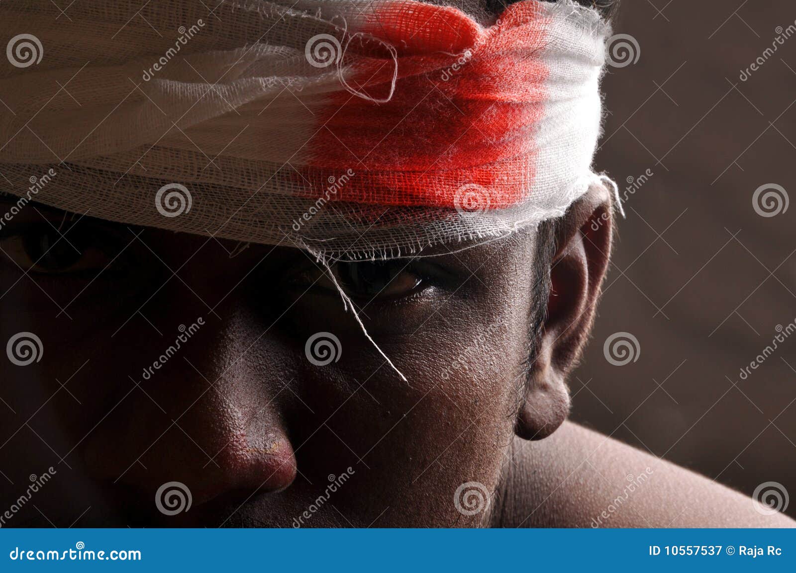 Wounded person stock image. Image of heal, body, health - 10557537 Wounded person stock image. Image of heal, body, health - 10557537