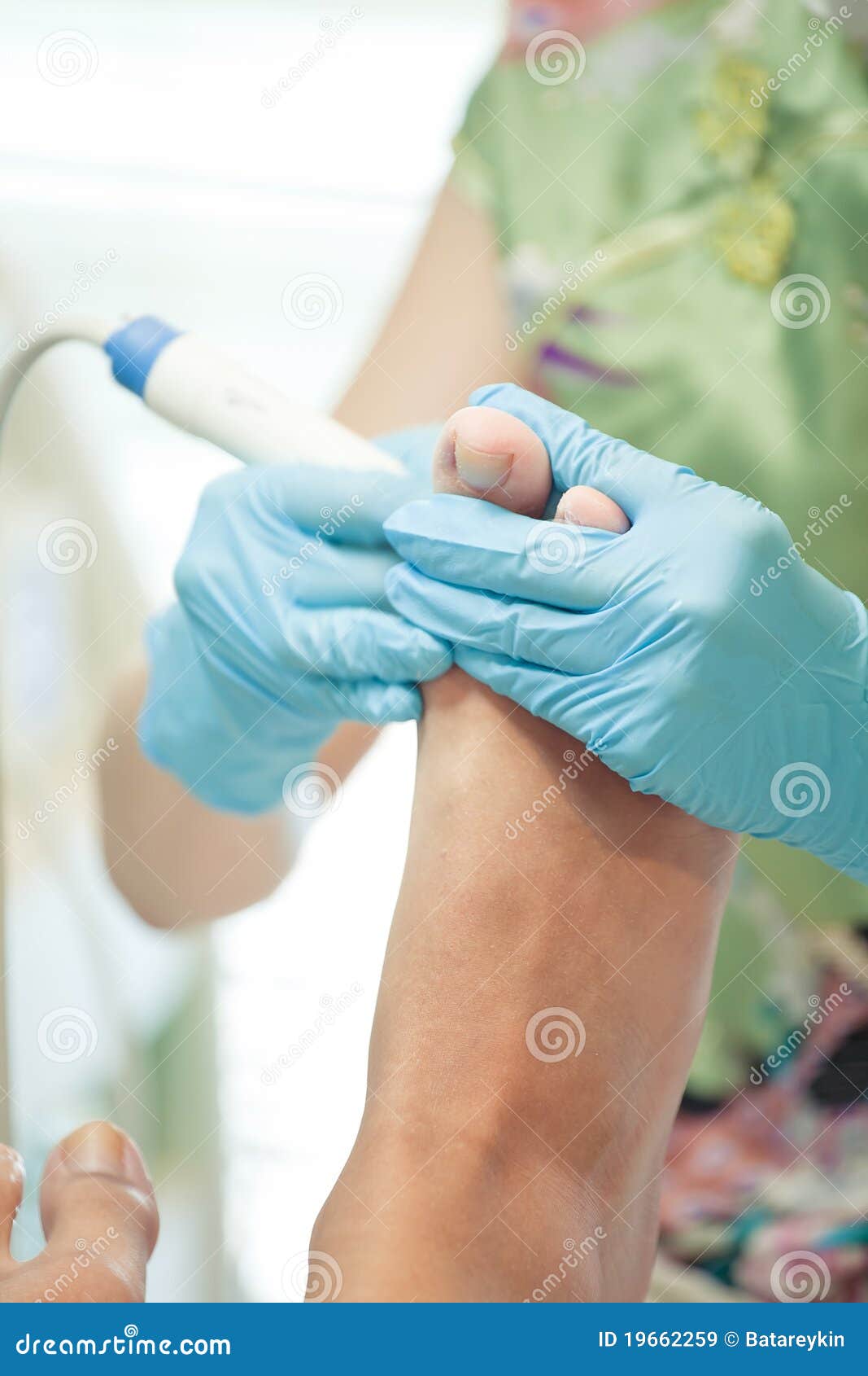 Wrap Feet Pedicure Procedure Stock Image - Image of doctor, correction ...