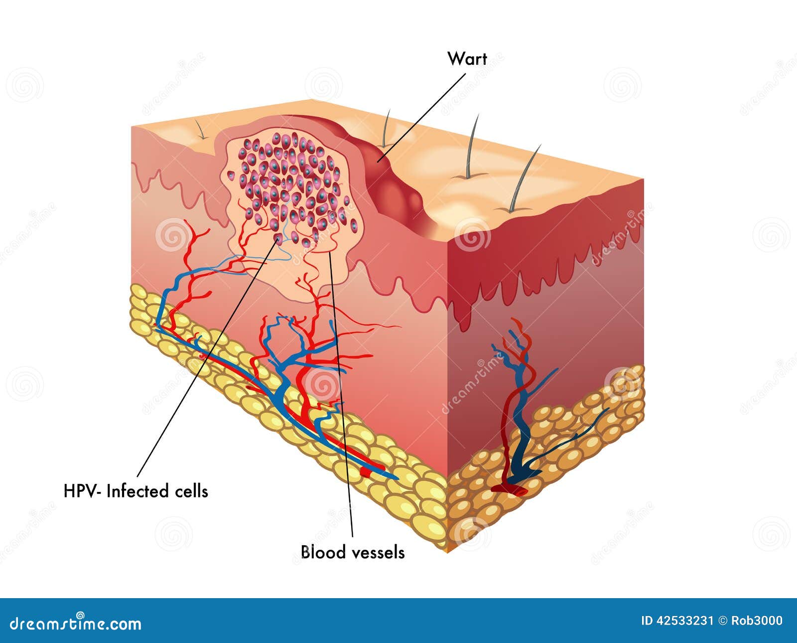 Wrat vector illustratie. Illustration of wijfje, opperhuid - 42533231