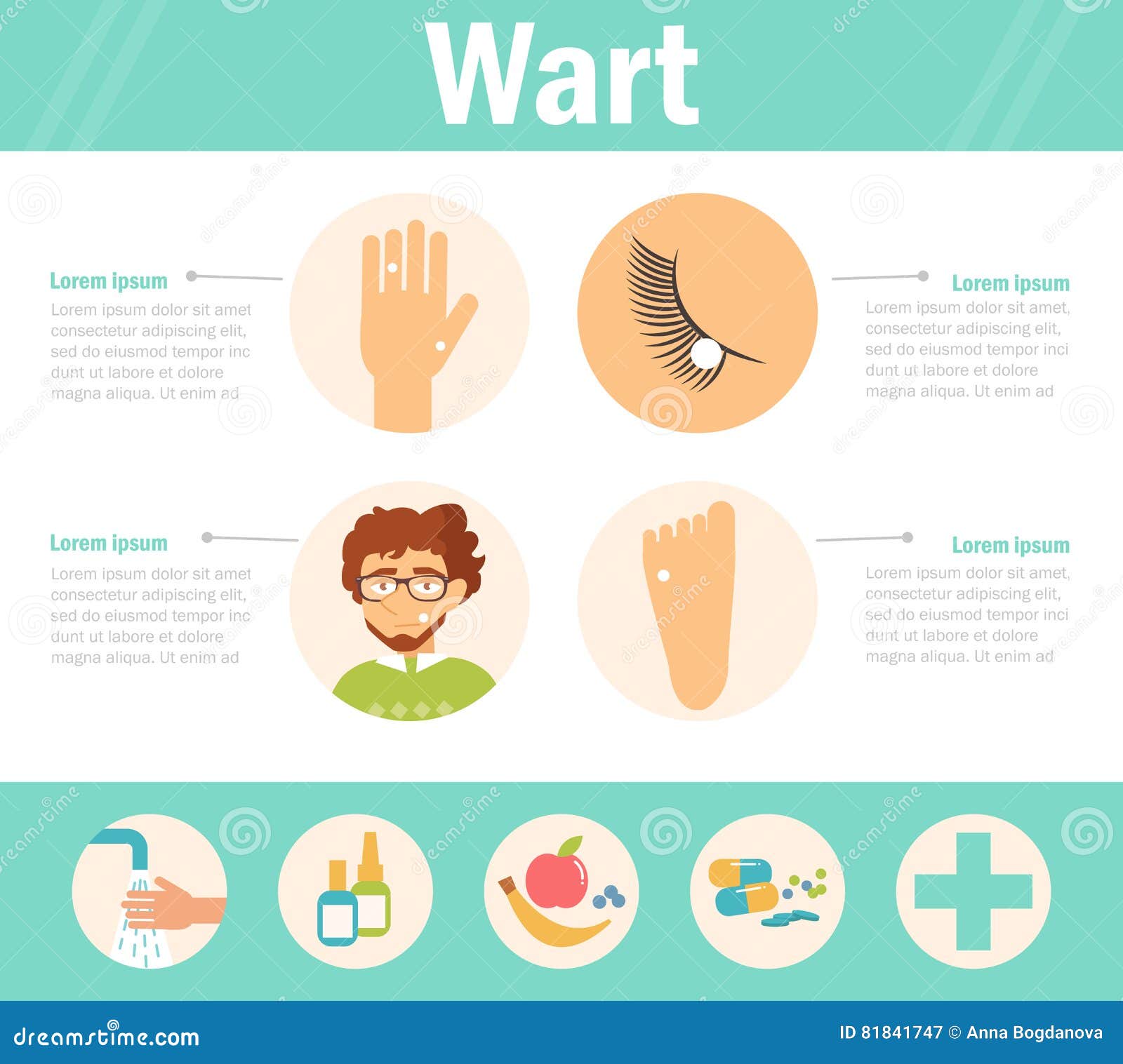 Wrat Types op de hand, vector illustratie. Illustration of vinger ...