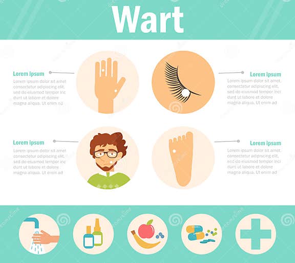 Wrat Types op de hand, vector illustratie. Illustration of vinger ...